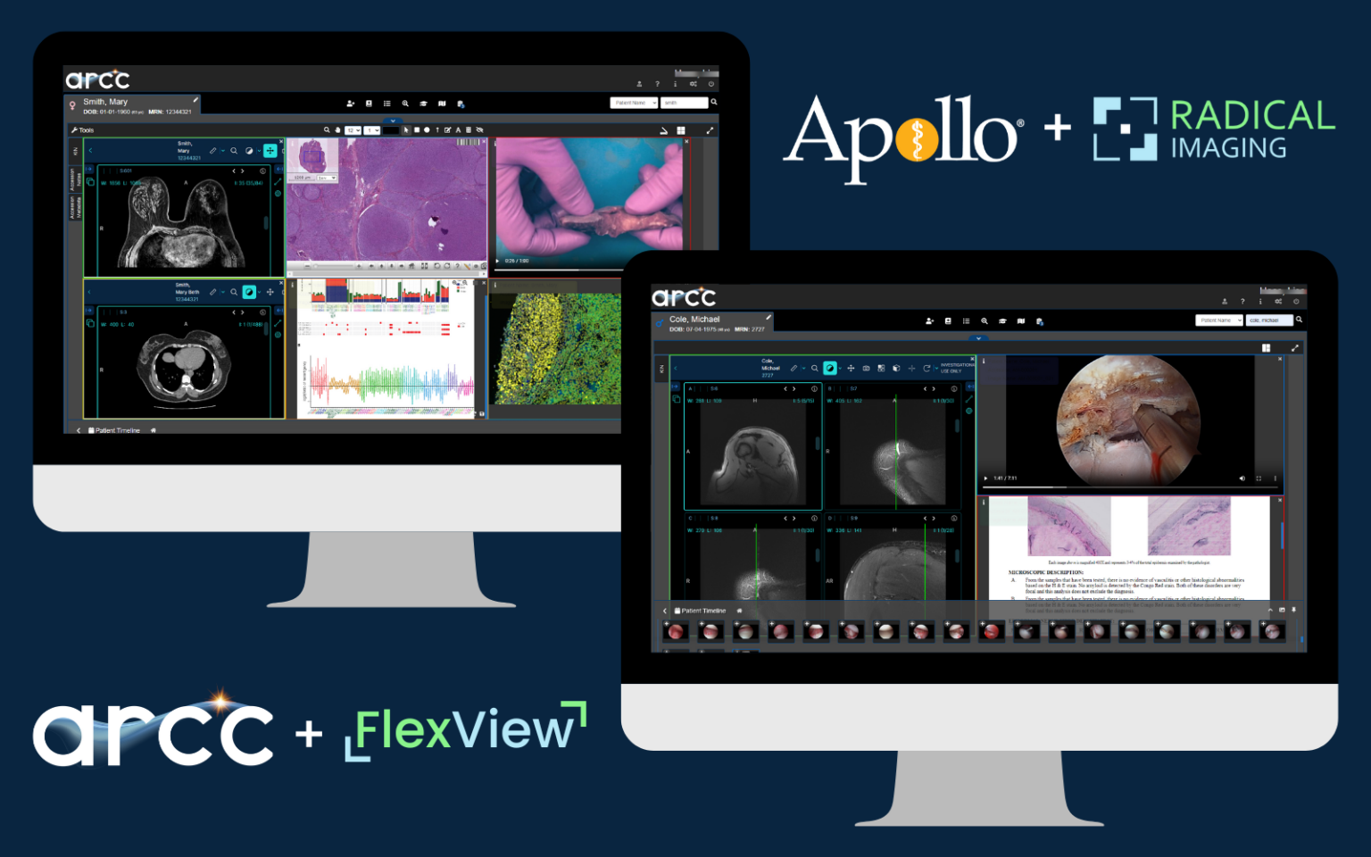 Apollo Partners with Radical Imaging - Enterprise Imaging | Manage ...