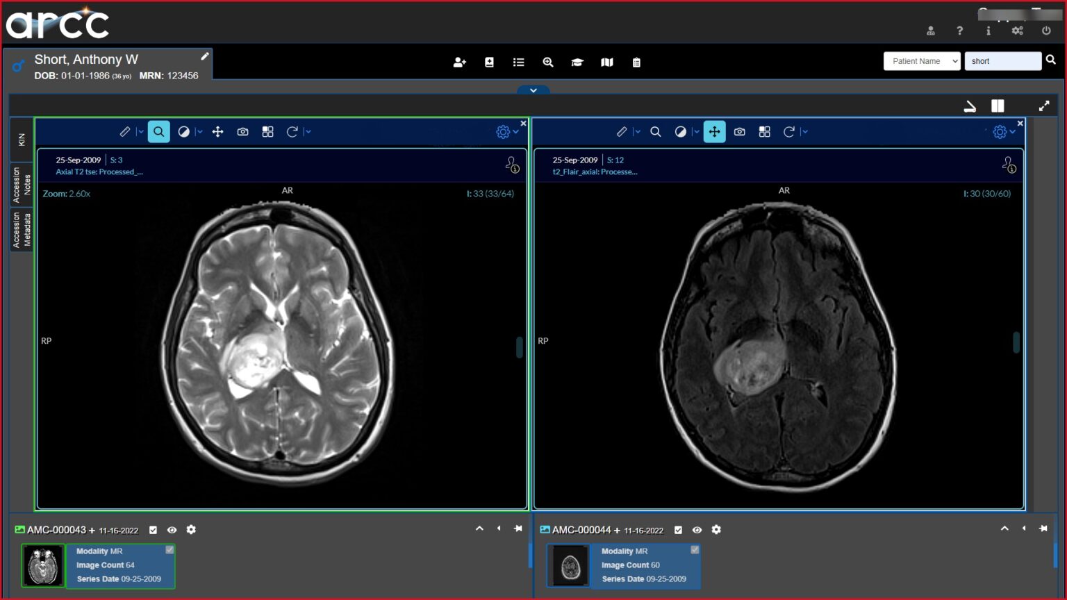 Apollo Demos New Workflows at RSNA22 - Enterprise Imaging | Manage ...